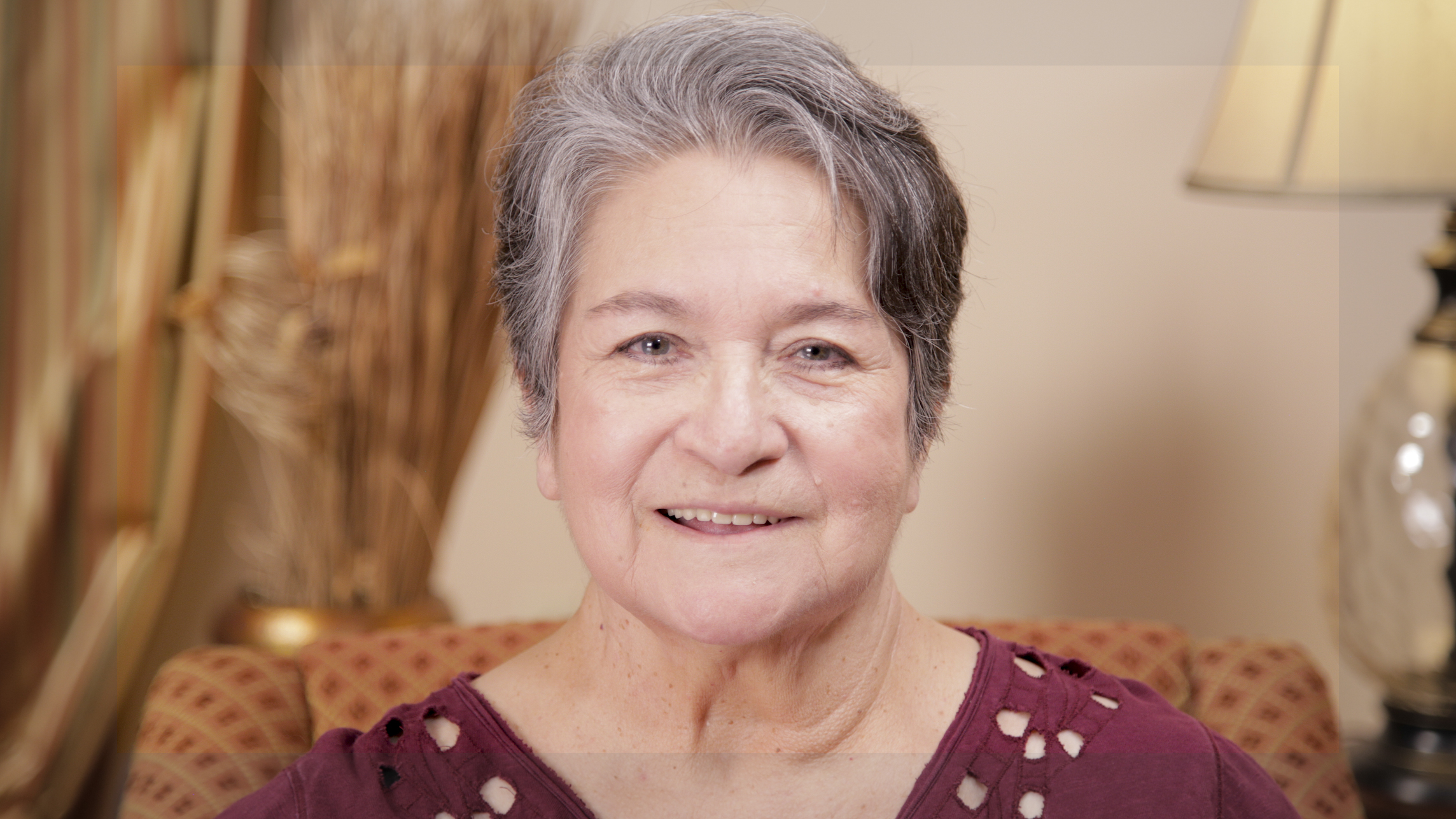 Bertha Needed Extractions, Bone Grafting, and Dental Implants in Las ...